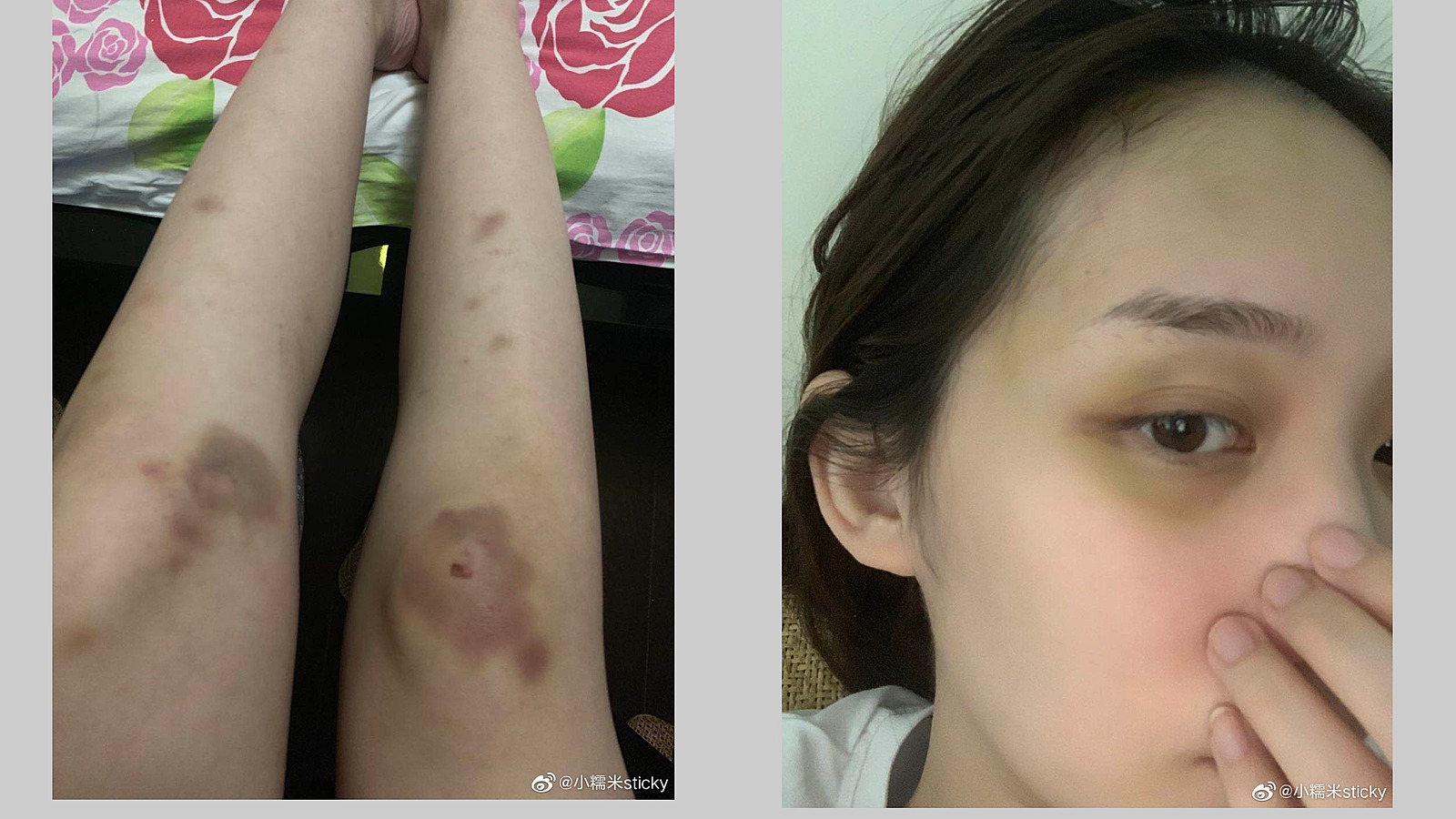 Хронология скандала в Китае: xiao8 обвиняют в ставках на $1,5 миллиона, в том числе против PSG ...